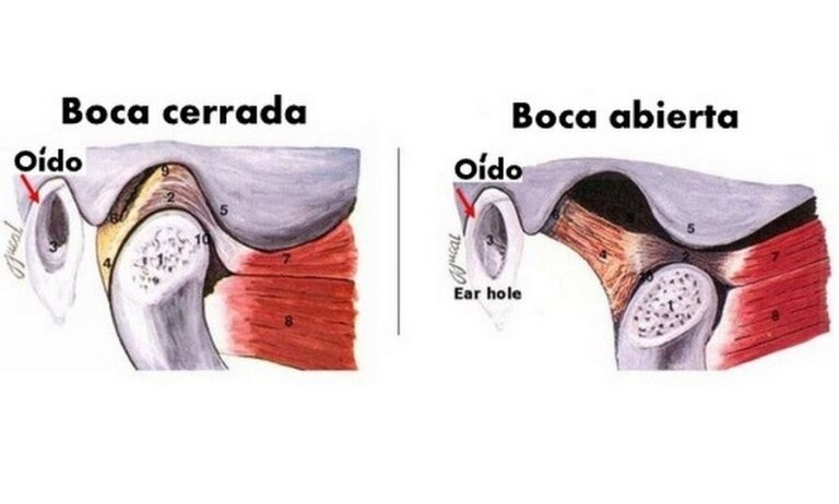 Anatomía de la ATM Articulación temporomandibular - Info acúfenos